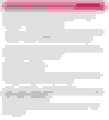 Easy Entry settings - AudiWorld Forums